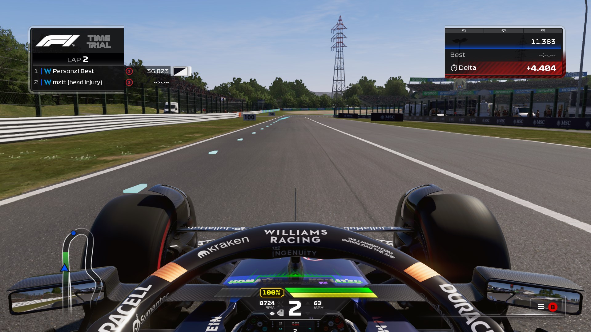 Best F1 24 camera settings – Destructoid